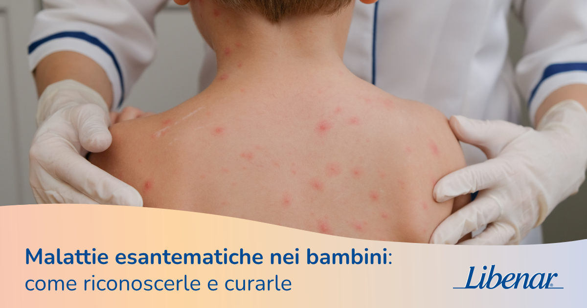 Malattie esantematiche nei bambini: come riconoscerle e curarle